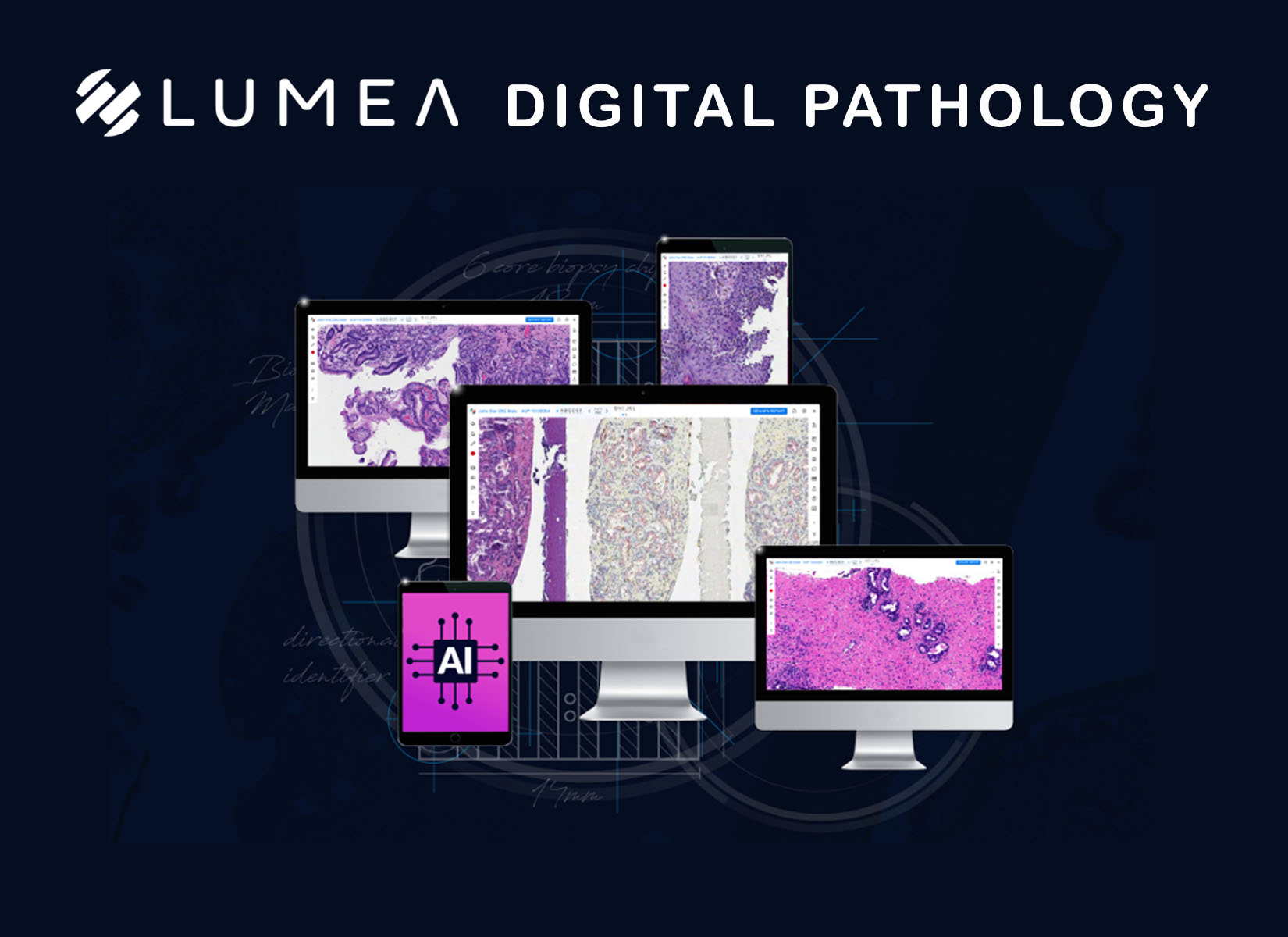 Acupath Adopts Lumea Digital Pathology - Acupath Laboratories